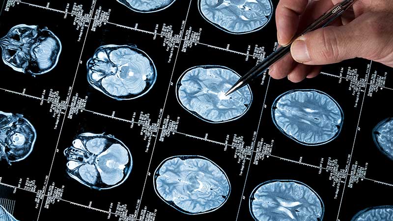 Free CME: Stay Updated and Earn Free CME Credit | AAFP