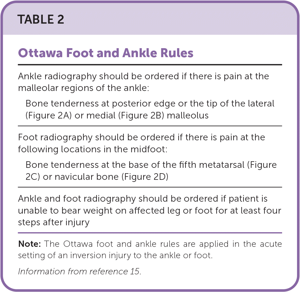 Common Foot Fractures | AAFP