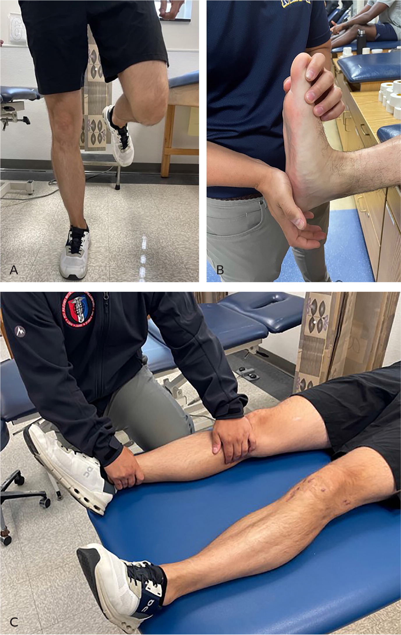 Bone Stress Injuries: Diagnosis and Management | AAFP