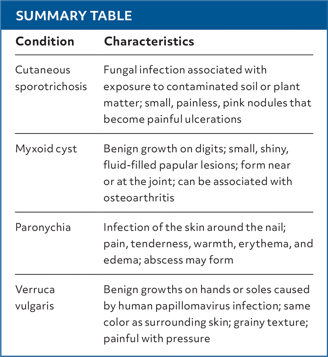 Painful Finger Lesion | AAFP