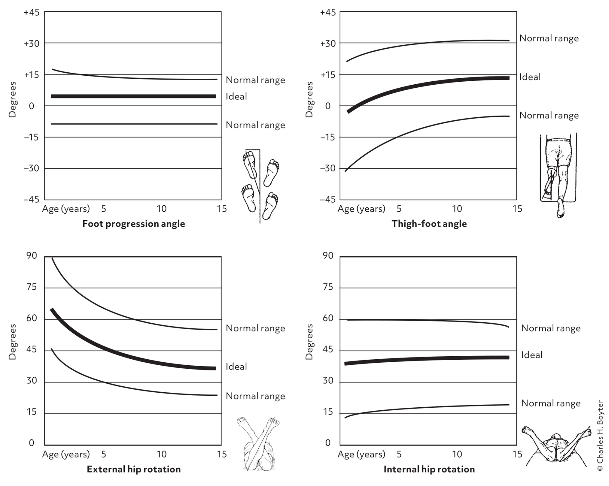 Lower Extremity Abnormalities in Children | AAFP