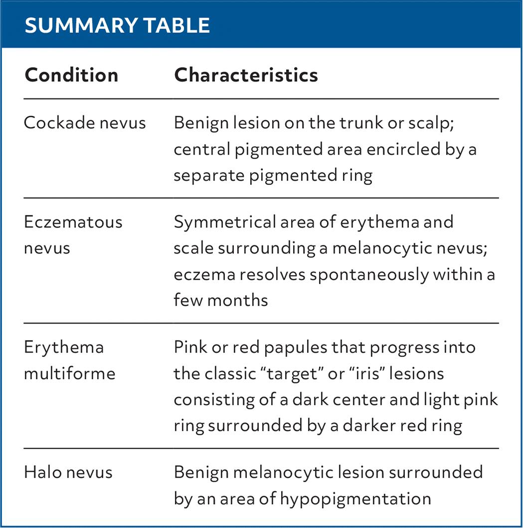 Child With a Single Small Lesion | AAFP