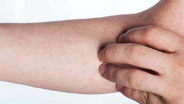 Dermatology CME | AAFP