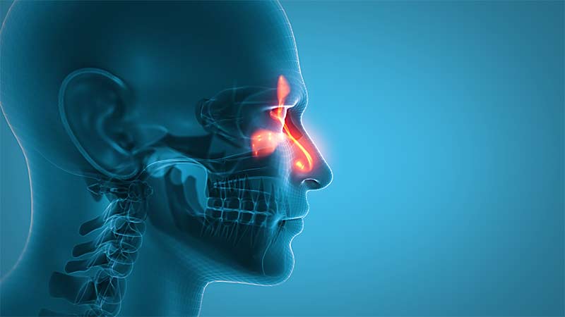 Chronic Rhinosinusitis Online CME | AAFP