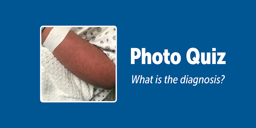 Circular Skin Lesion | AAFP