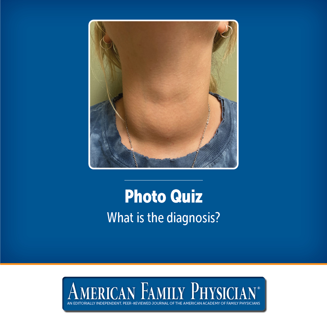 A Growing Goiter | AAFP