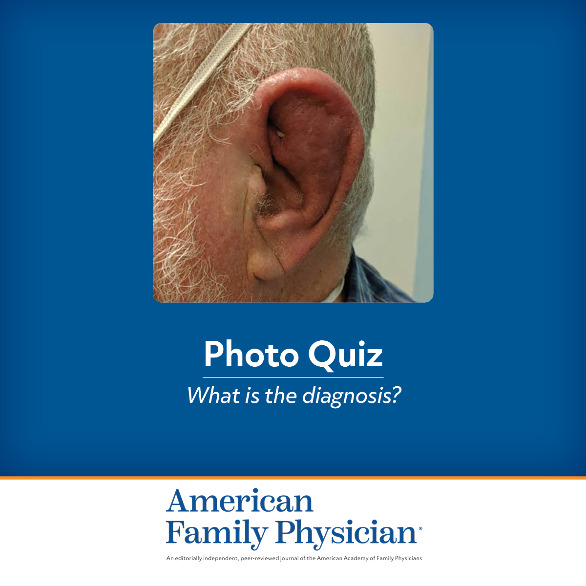 Painful, Red, Swollen Ear | AAFP