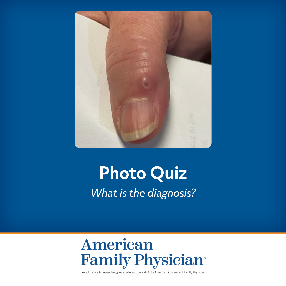 Painful Finger Lesion | AAFP
