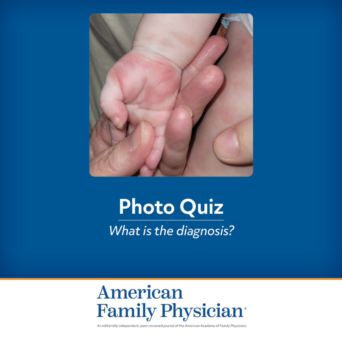 Recurrent Rash in a Newborn | AAFP