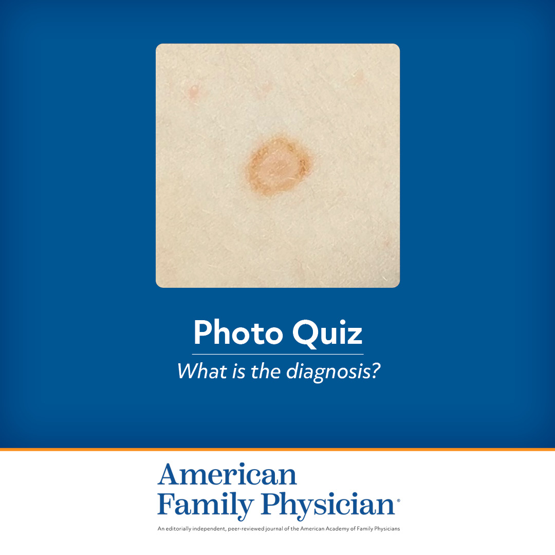 Child With a Single Small Lesion | AAFP